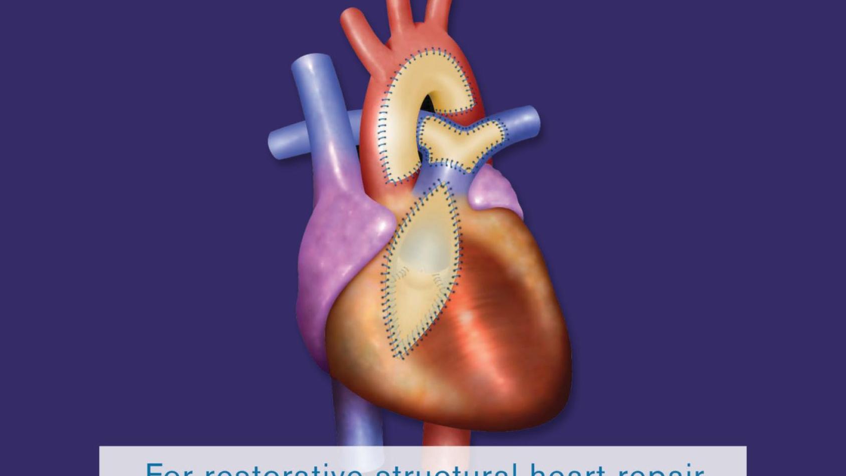 CardioCel® Bioscaffold Patch | LeMaitre